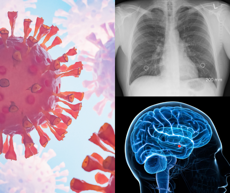 Contribute to science: open call for participants who have had a non ...